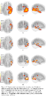 Automated-Visualization-of-Ictal-and-Interictal-SEEG-Activity-to ...